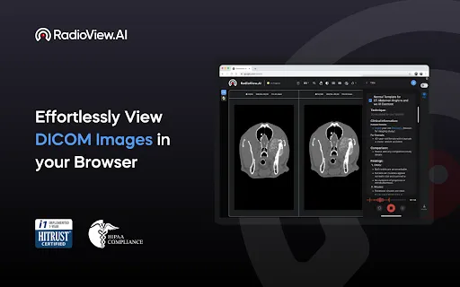 RadioView.AI: Automated Radiology Report Generation | Creati.ai